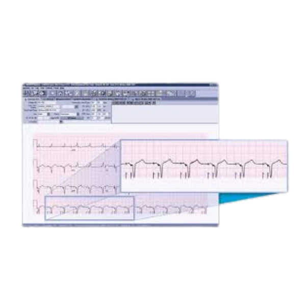 GE Muse NX Software Package | Heart Medical