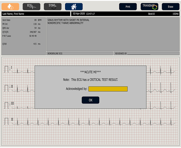 Welch Allyn ELI 380 EKG Machine | Heart Medical