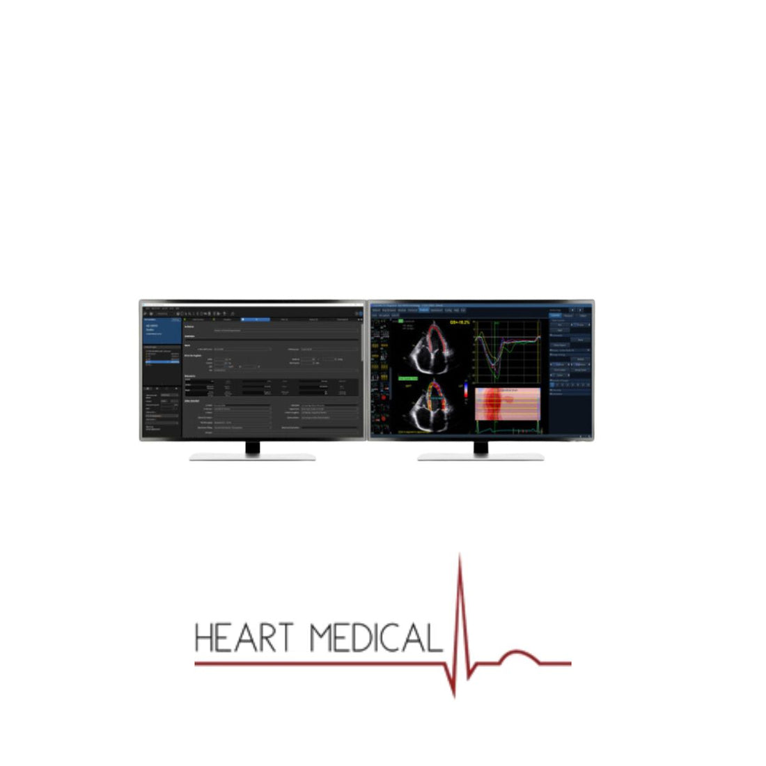 GE ViewPoint 6 Ultrasound | Reporting and Image Management