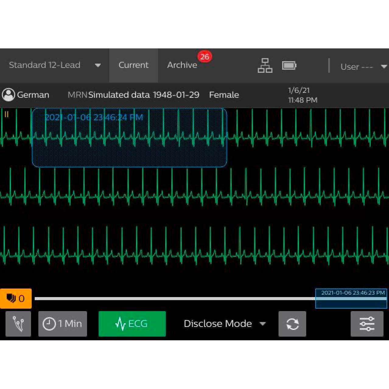 Philips TC35 Pagewriter EKG Machine | Heart Medical