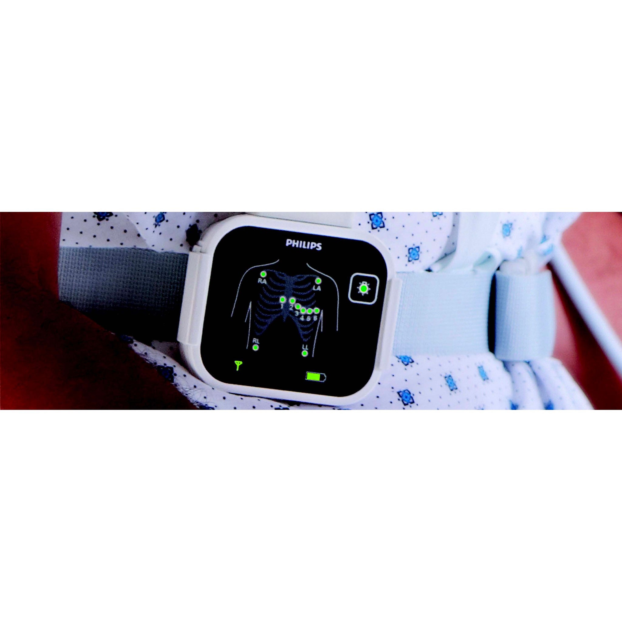 Buy Philips ST80i | Certified Medical Equipment & Supplies