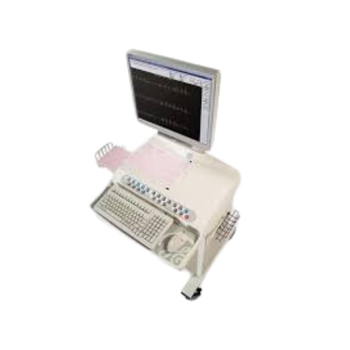 ECG MUSE | GE Cardiology Information System V5 to V9