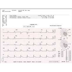 Philips TC35 Pagewriter EKG Machine | Heart Medical