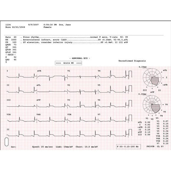 Philips TC35 Pagewriter EKG Machine | Heart Medical